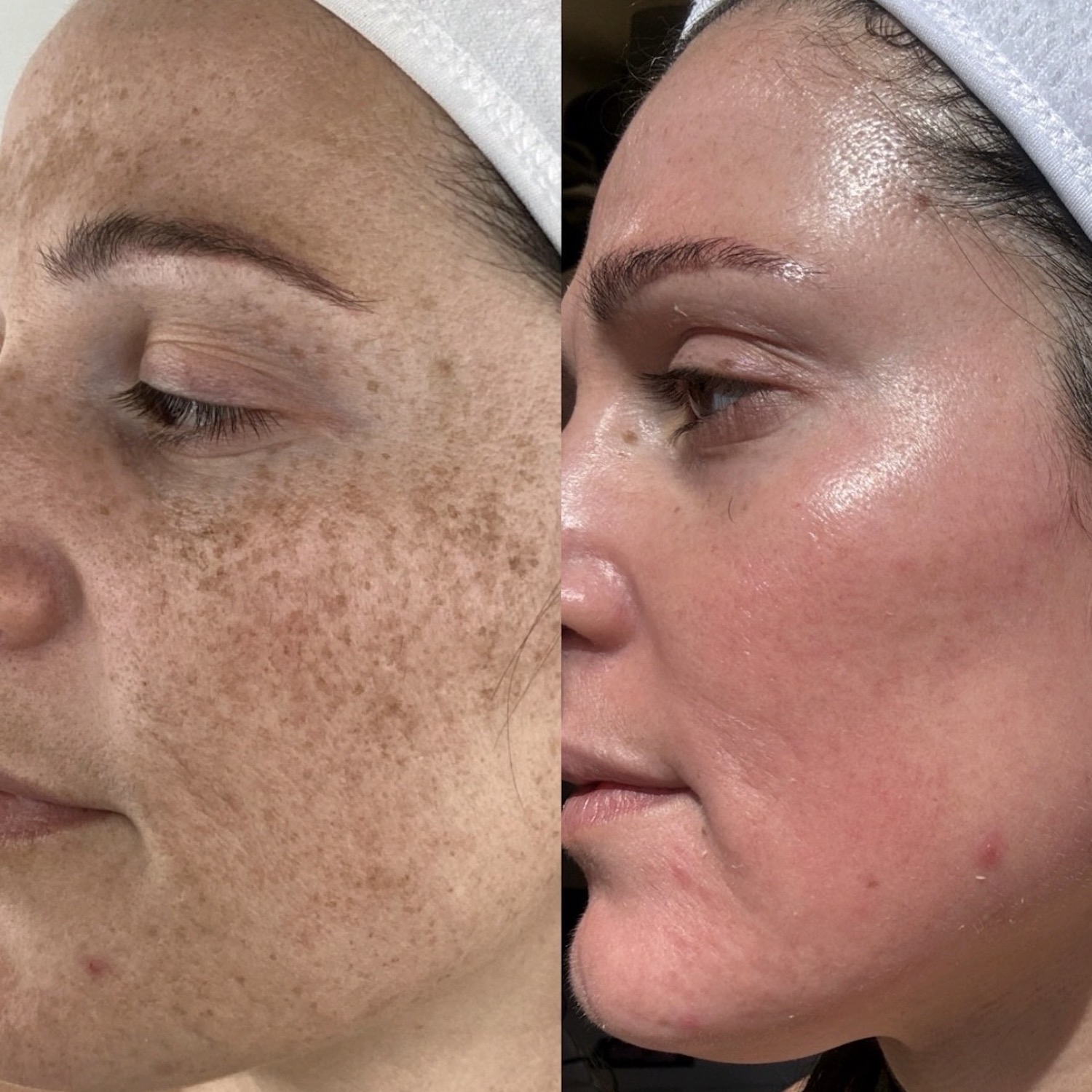 Med Spa in St George Utah - Amor Med Spa and Aesthetics